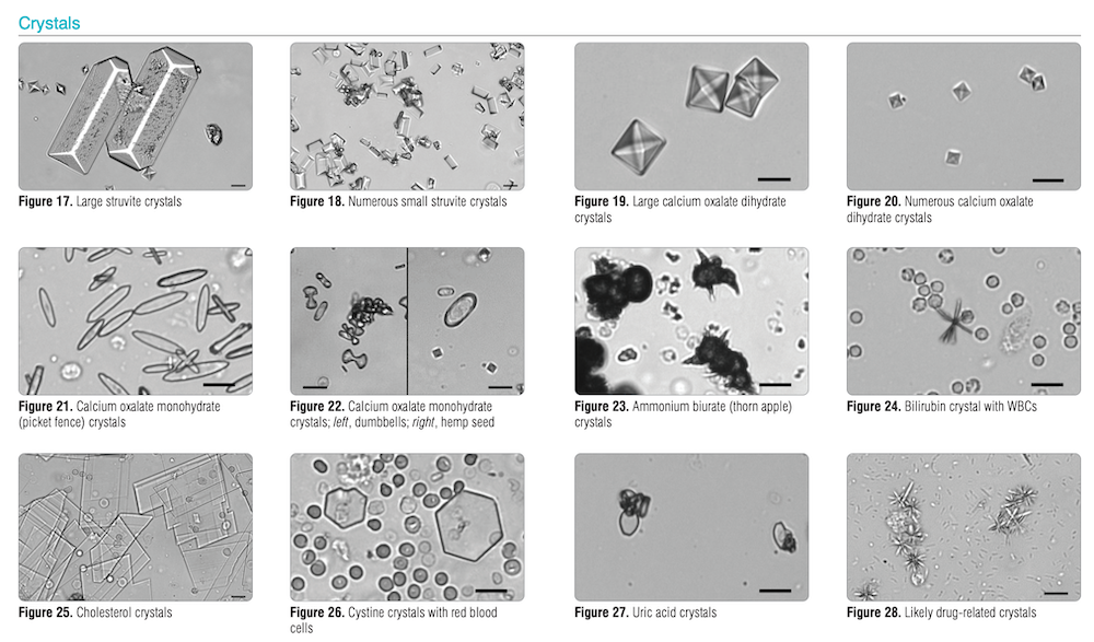 Crystals in Cat Urine: Signs, Causes, & Treatment